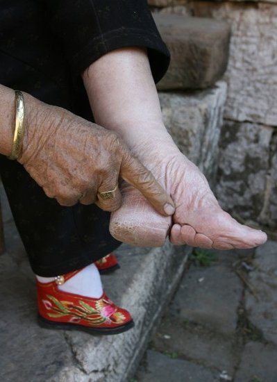 The Strangest Beauty Trends in History | by Beyond Truth | Lessons from ...